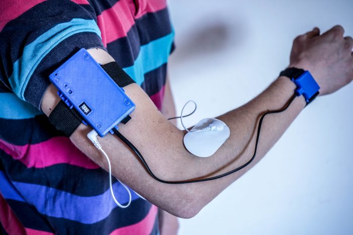 Regain Biomedical - GRACE Device